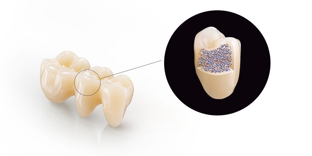 VITA VIONIC DENT DISC multiColor